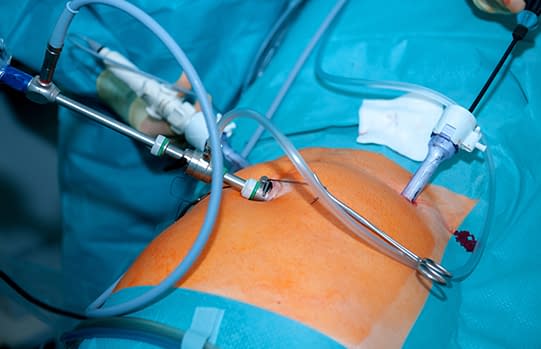 Minimally Invasive Surgery | Tyler & Longview Orthopedic Surgeons